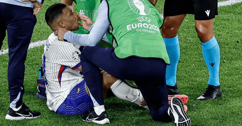 Kylian Mbappe Euro 2024 injury